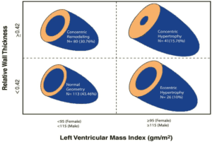 Clinical Correlation of Left Ventricular Geometric Patterns at King ...